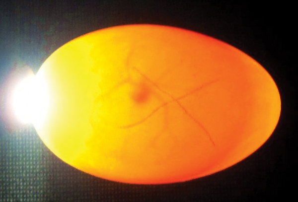 Candling Eggs and Advanced Techniques for Artificial Incubation and ...